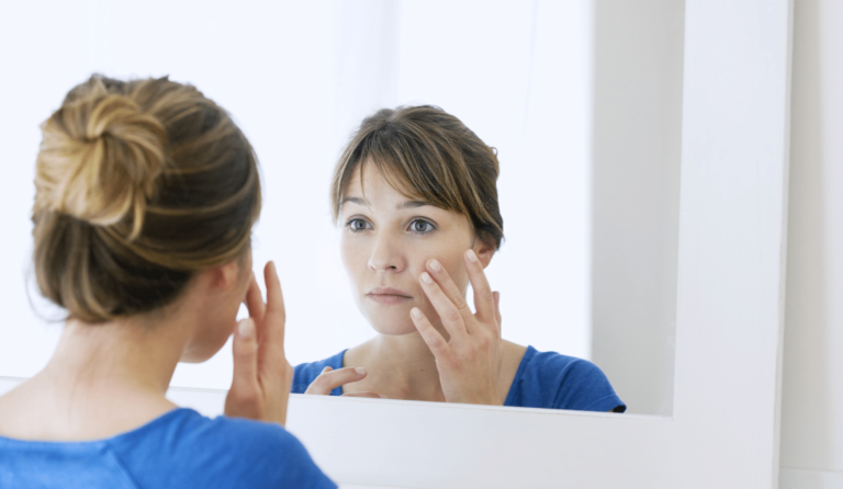 paupières - Association Française de l'eczéma