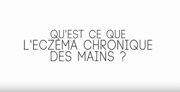 Eczéma Chronique des Mains - Association Française de l'eczéma