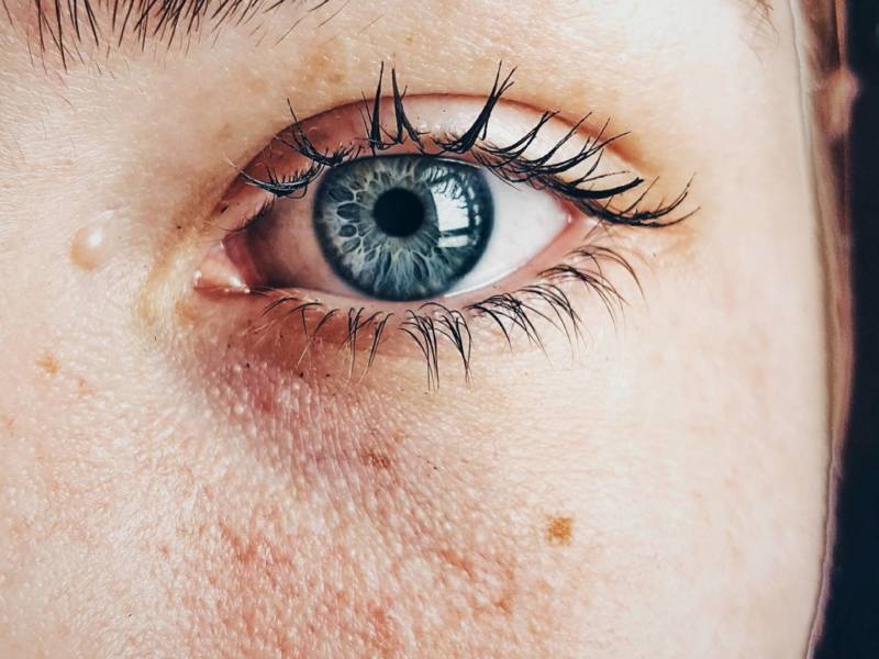 Qu'est-ce que l'atopie ? - Association Française de l'eczéma