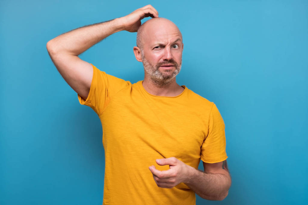 Dermatite séborrhéique du cuir chevelu : ce qu’il faut savoir ...